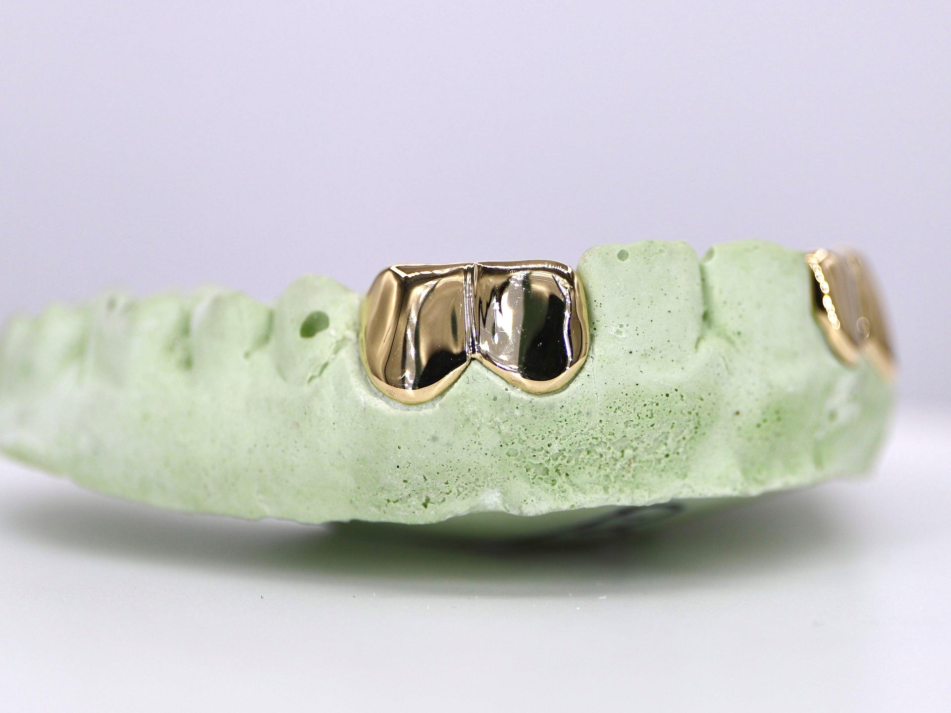 2 Solid Gold Teeth Grillz – Moissanite Bazaar