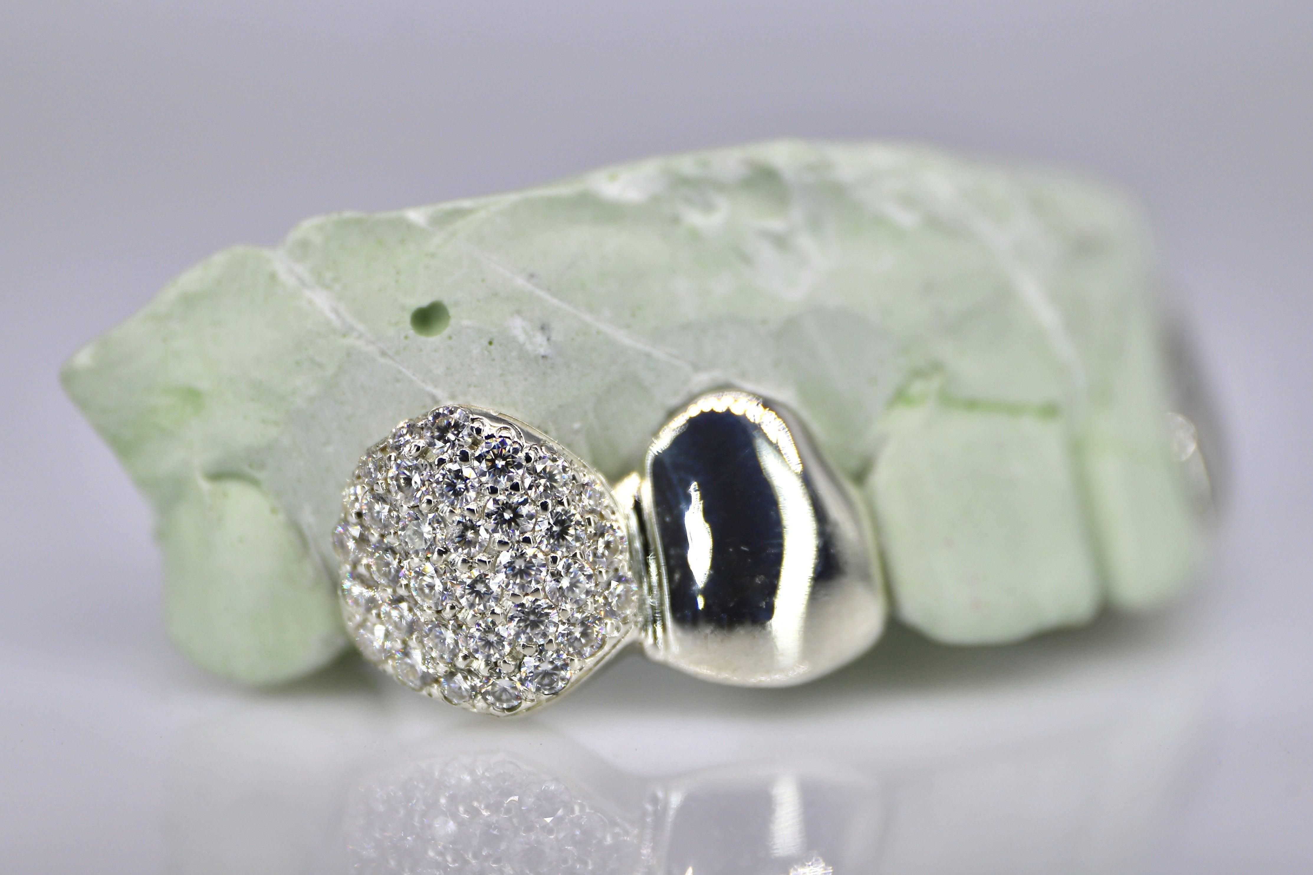 2 Teeth VVS Moissanite Diamond with Solid Ends Grillz – Moissanite Bazaar