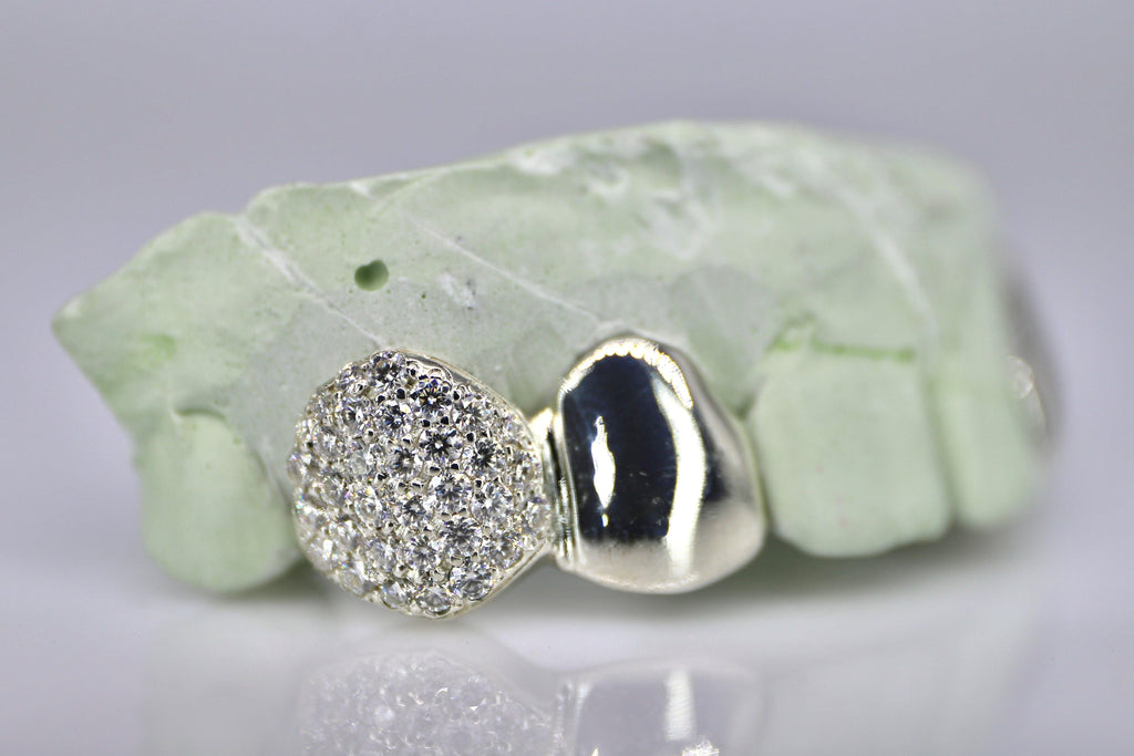 2 Teeth VVS Moissanite Diamond with Solid Ends Grillz – Moissanite Bazaar