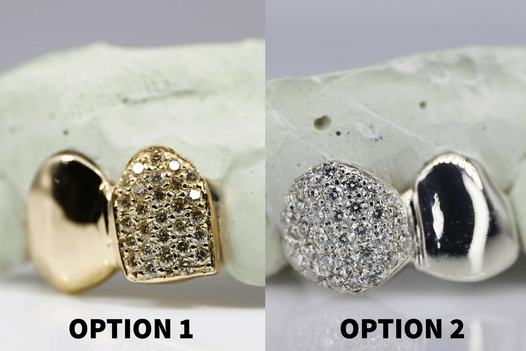 2 Teeth VVS Moissanite Diamond with Solid Ends Grillz – Moissanite Bazaar