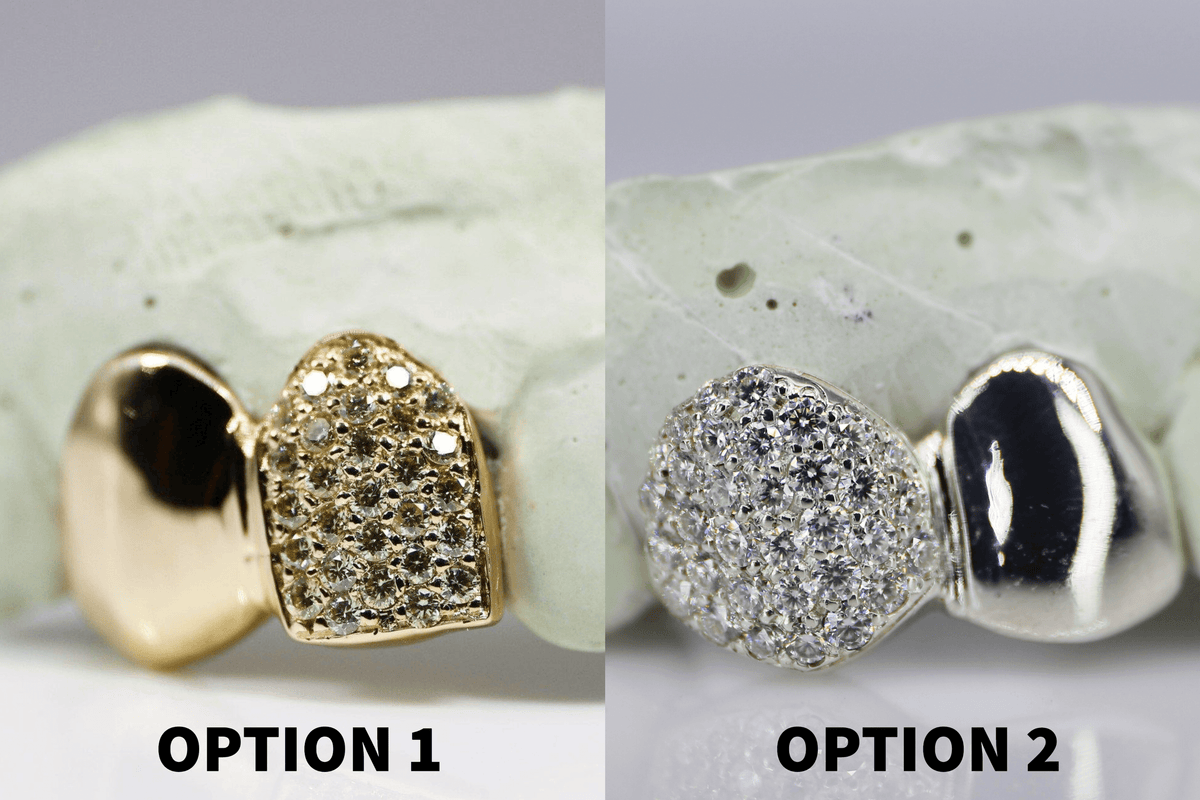 2 Teeth VVS Moissanite Diamond with Solid Ends Grillz – Moissanite Bazaar