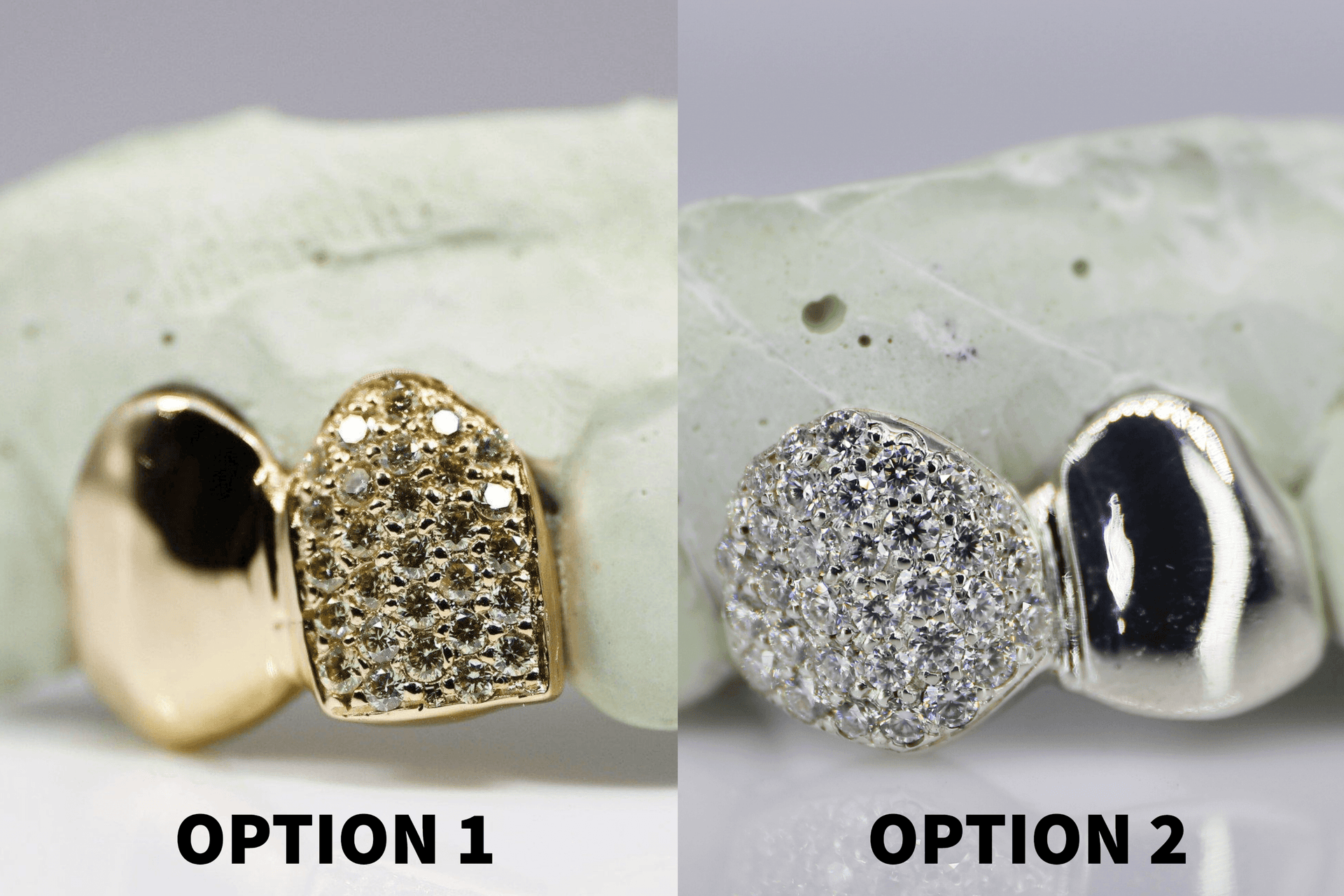 2 Teeth VVS Moissanite Diamond with Solid Ends Grillz – Moissanite Bazaar