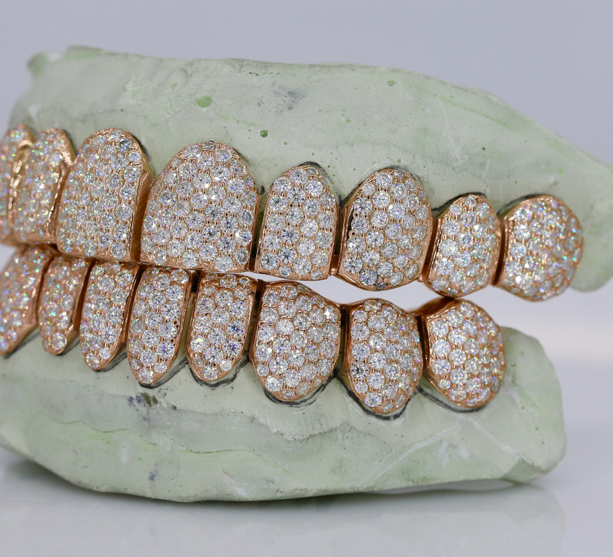 Moissanite Grillz – Moissanite Bazaar
