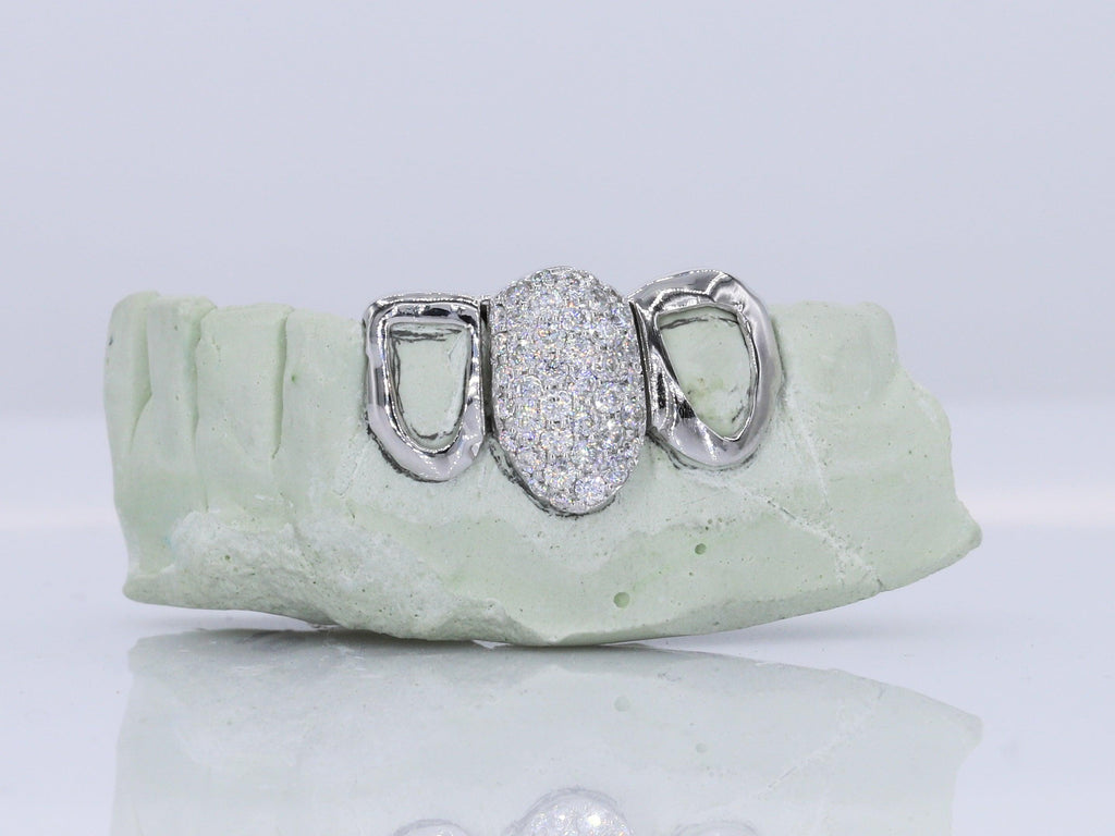1 Tooth Diamond & 2 Teeth Open Faced VVS Moissanite Diamond Grillz ...