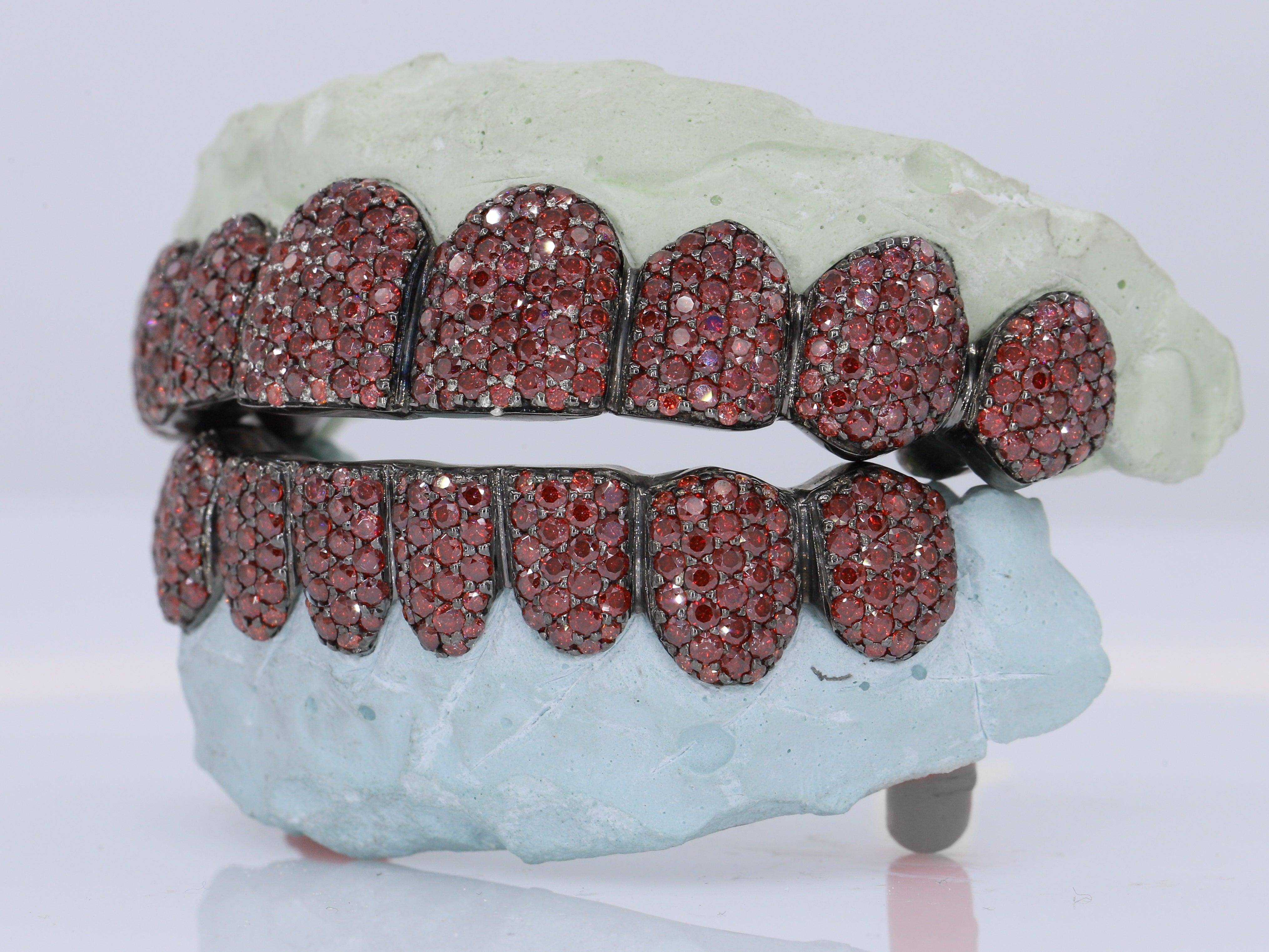 Blood Red VVS Moissanite Diamond Grillz – Moissanite Bazaar