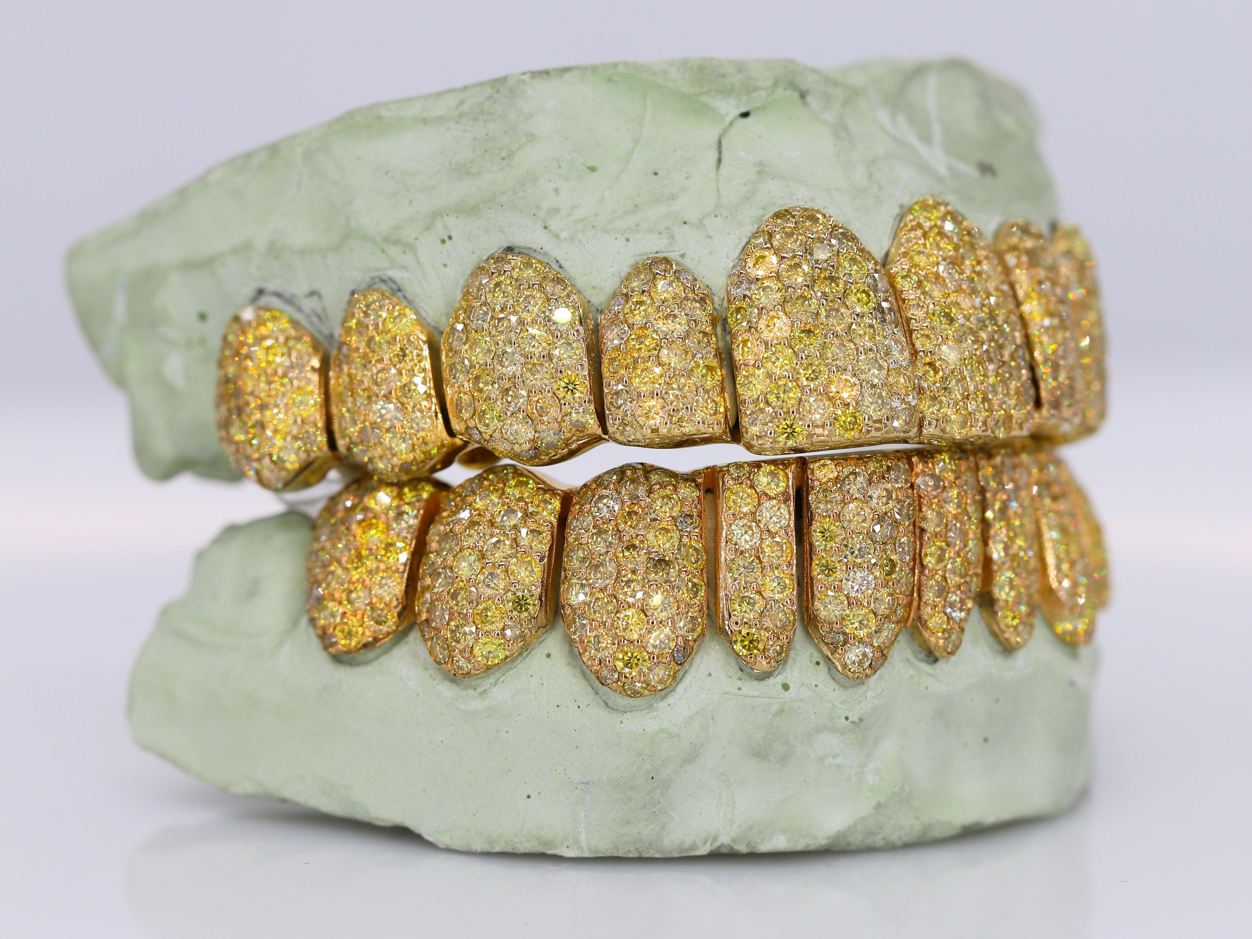 Colored Stone Grillz – Moissanite Bazaar