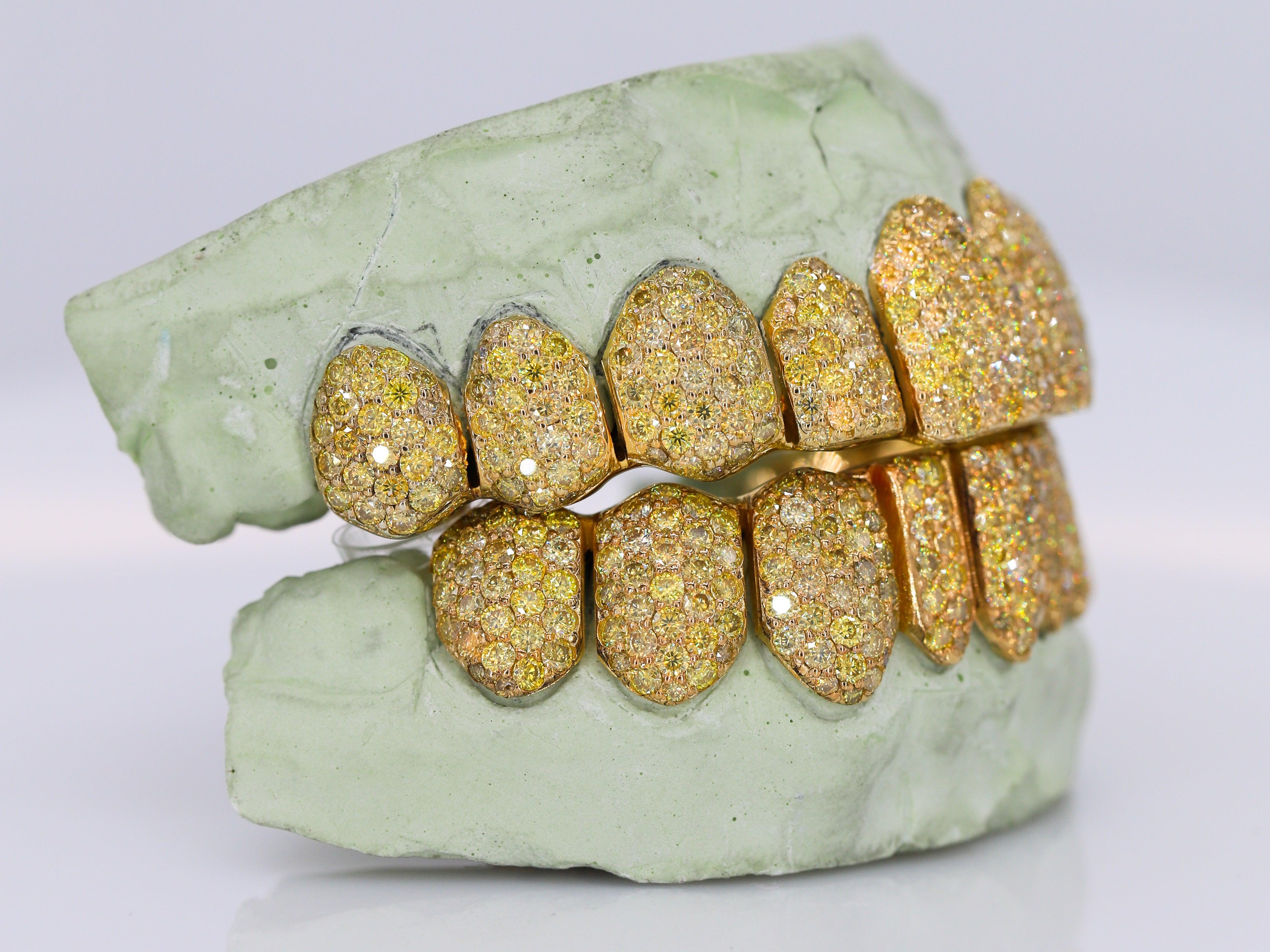 Colored Stone Grillz – Moissanite Bazaar