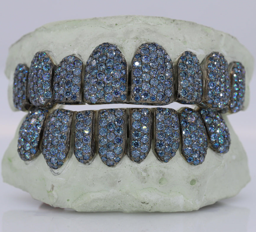Colored Stone Grillz – Moissanite Bazaar
