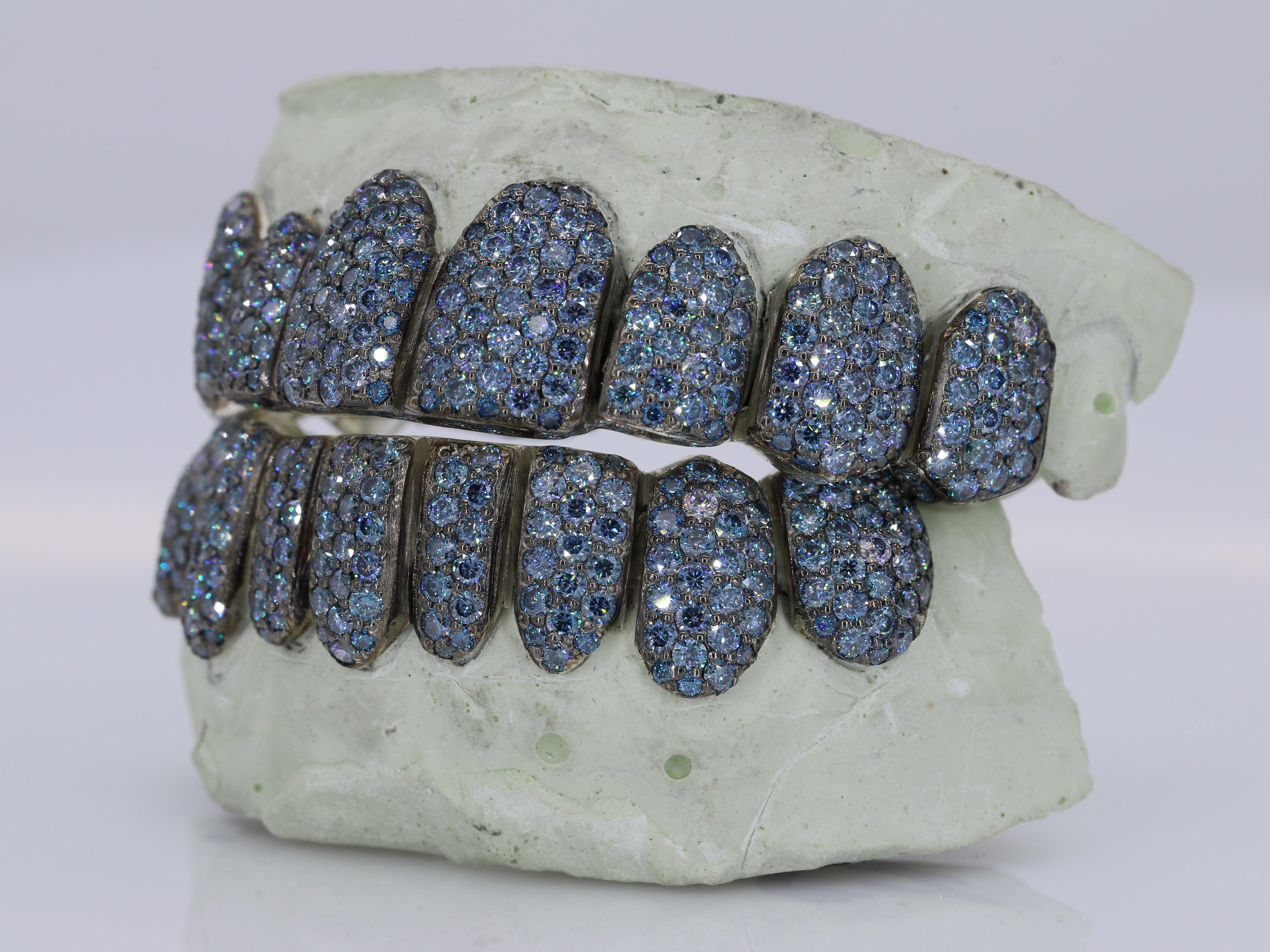 Colored Stone Grillz – Moissanite Bazaar