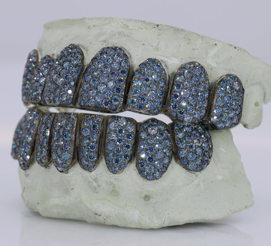 Colored Stone Grillz – Moissanite Bazaar