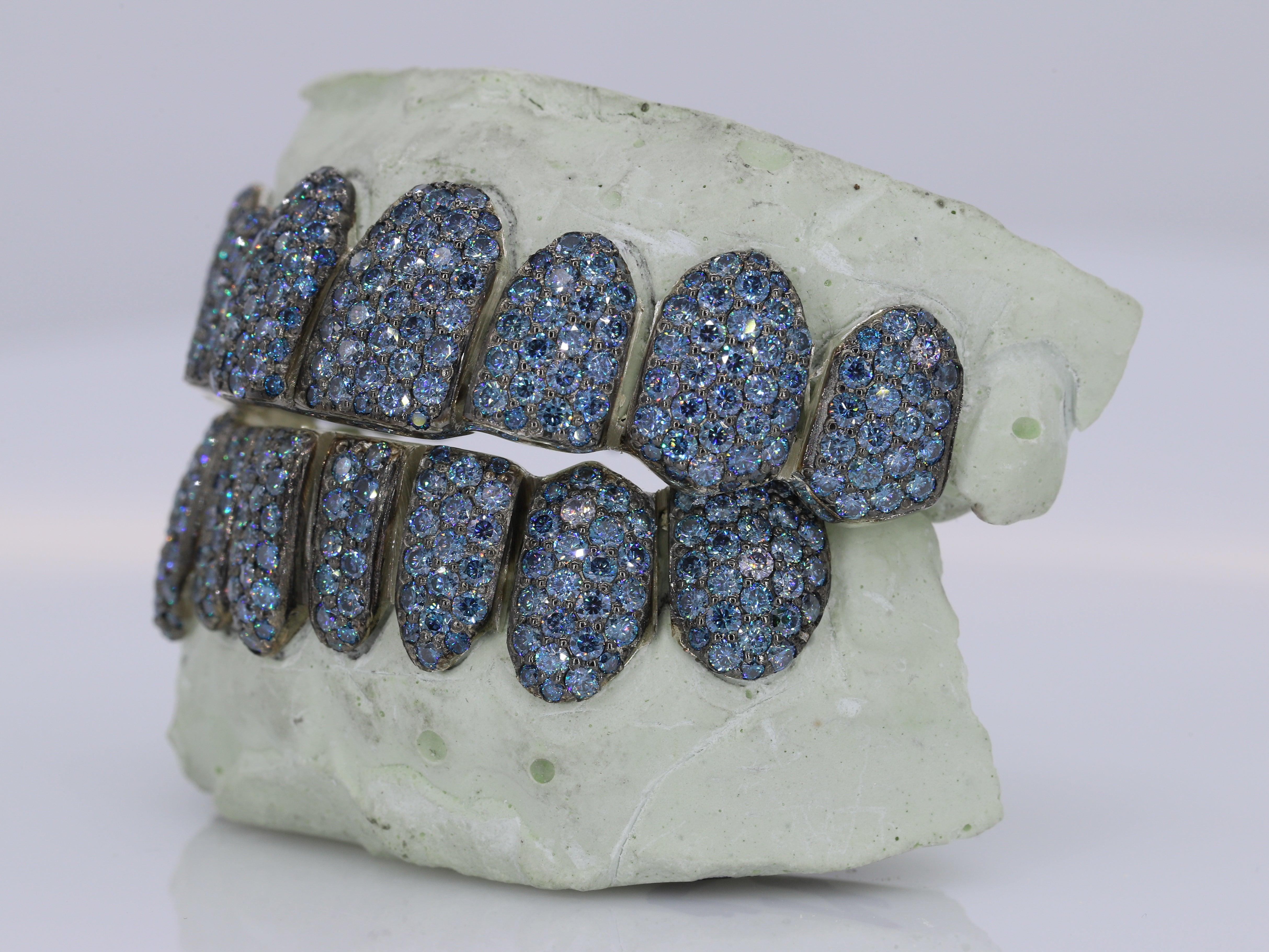 Colored Stone Grillz – Moissanite Bazaar