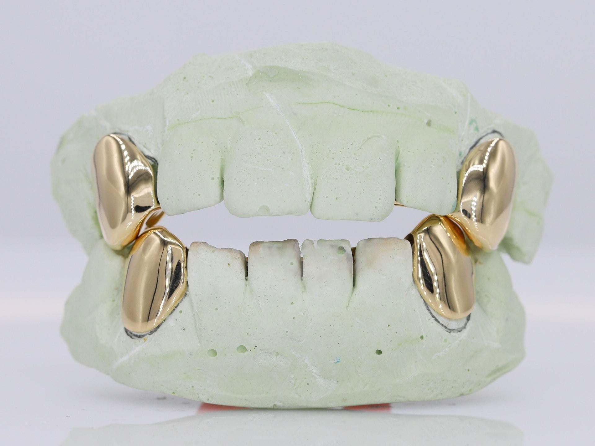 Gold Fangs Grillz – Moissanite Bazaar