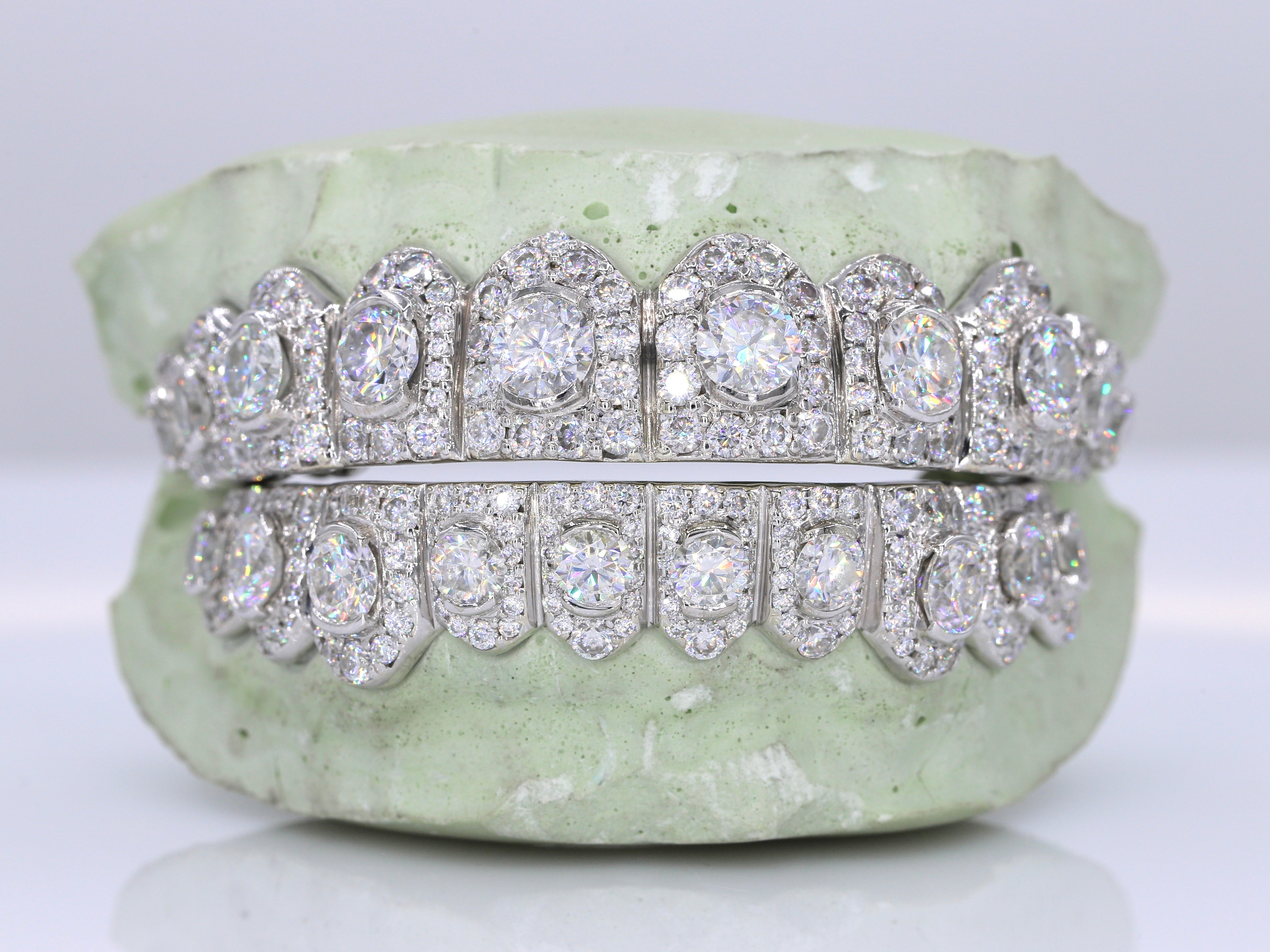 Pointer Stone Center VVS Moissanite Diamond Grillz – Moissanite Bazaar