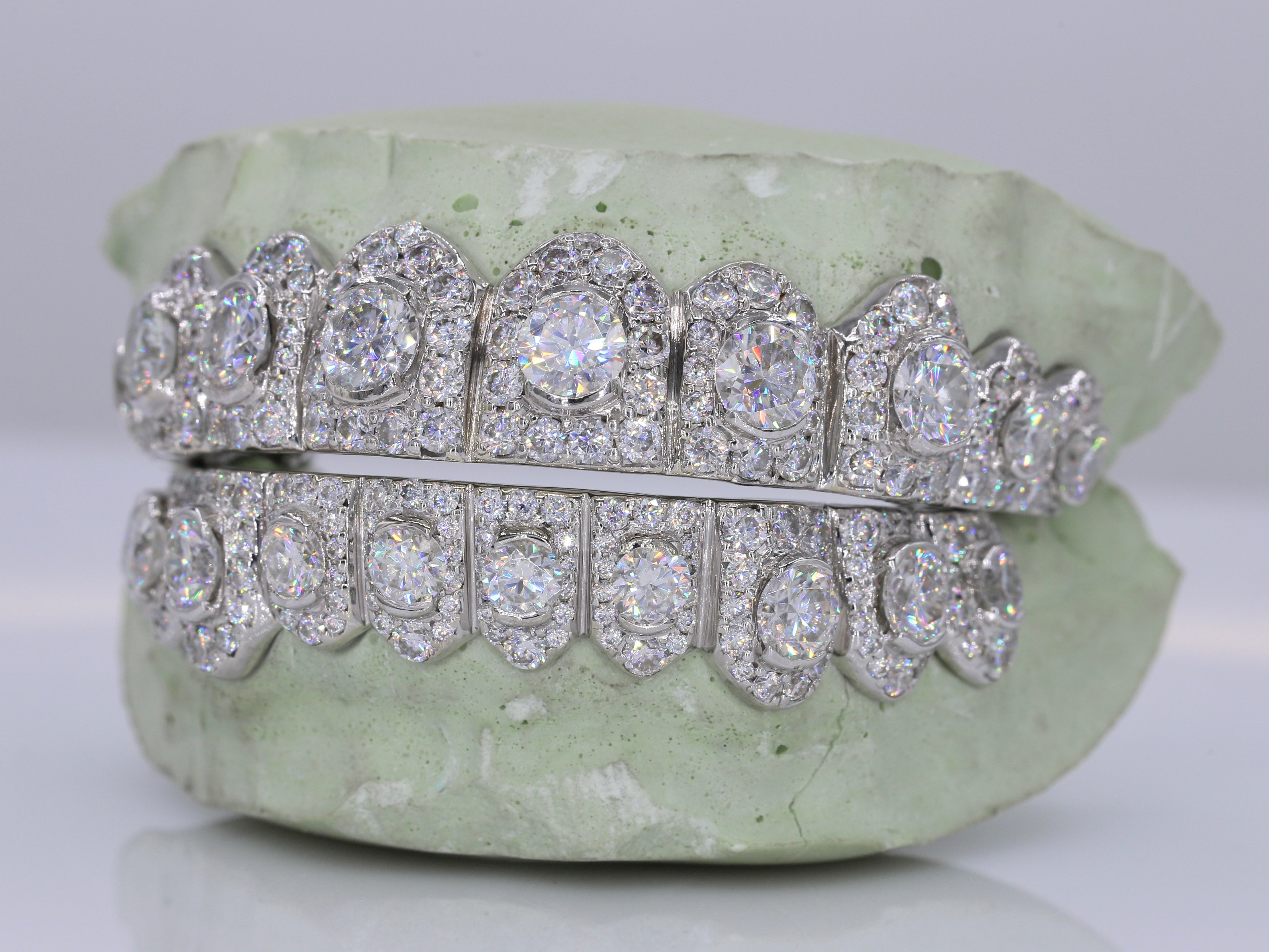 Pointer Stone Center VVS Moissanite Diamond Grillz – Moissanite Bazaar