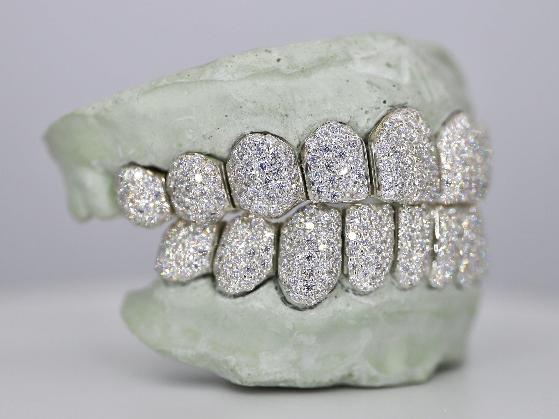 Customizable VVS Moissanite Diamond Grillz – Moissanite Bazaar