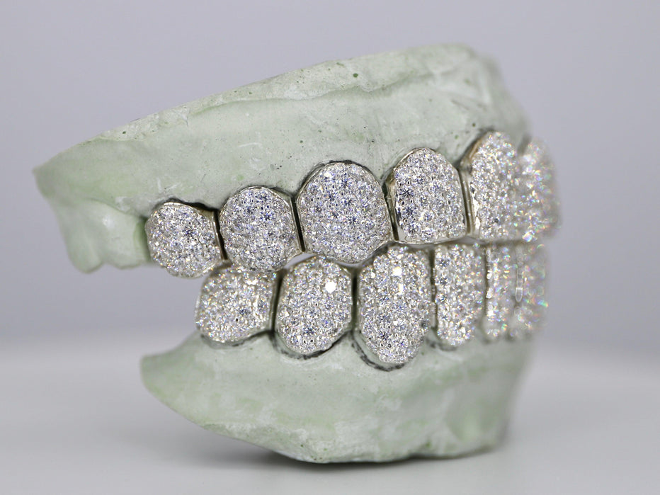 Customizable VVS Moissanite Diamond Grillz – Moissanite Bazaar