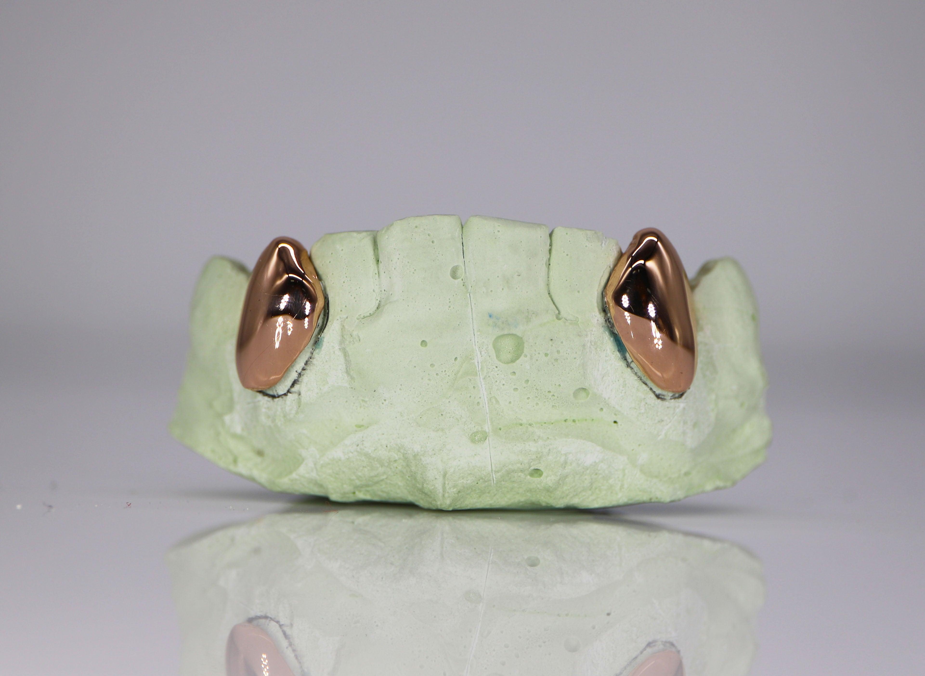 Gold Fangs Grillz – Moissanite Bazaar
